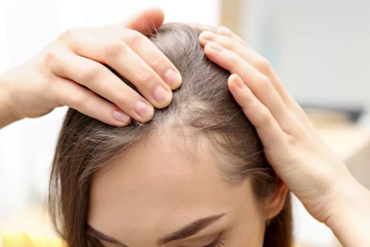 Hoofdhuidproblemen en dun(ner wordend) haar | Jonkers Haarmode